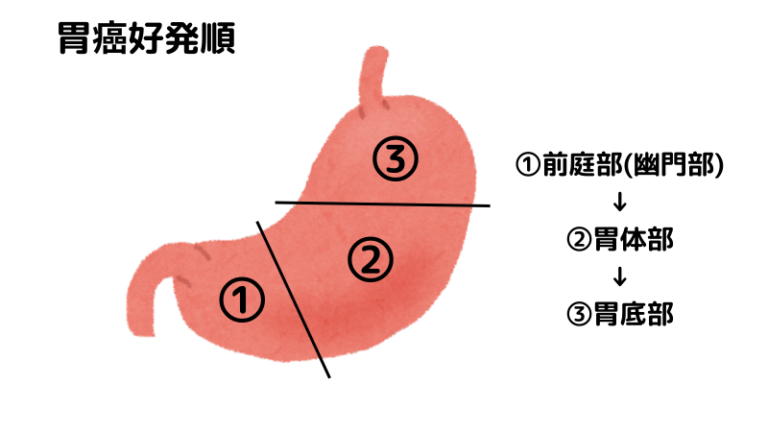 胃癌 好発部位 覚え方 語呂合わせ|*看護国試ゴロ*看護師国家試験対策 絶対合格するぞ!