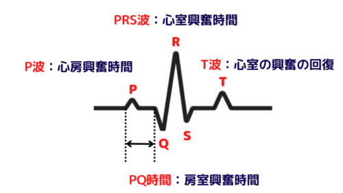 心電図 PQRST 各波形の意味 覚え方 語呂合わせ｜＊看護国試ゴロ＊看護師国家試験対策 絶対合格するぞ！